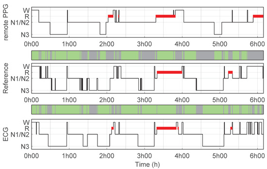 Contactless Camera-Based Sleep Staging: The HealthBed Study