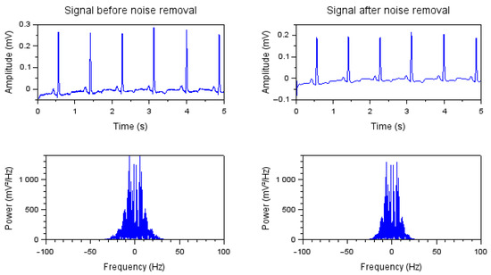 Bioengineering | Free Full-Text | ECG Measurement Uncertainty Based on ...