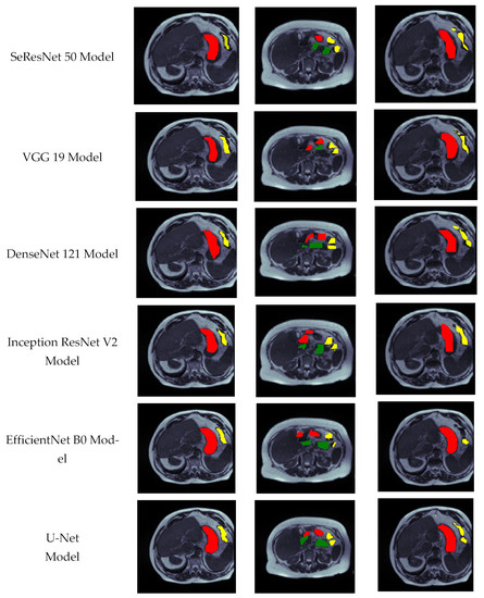 Bioengineering | Free Full-Text | U-Net Model with Transfer Learning ...