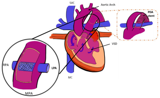 Bioengineering | Free Full-Text | In-Silico and In-Vitro Analysis of ...