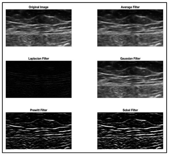 Deep Learning-Based Medical Images Segmentation of Musculoskeletal ...