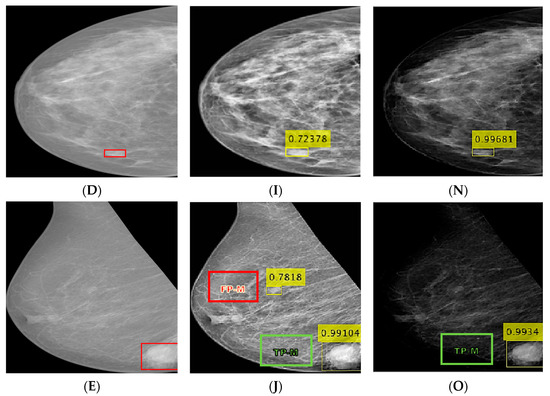 Bioengineering | Free Full-Text | Enhancement Technique Based on the ...