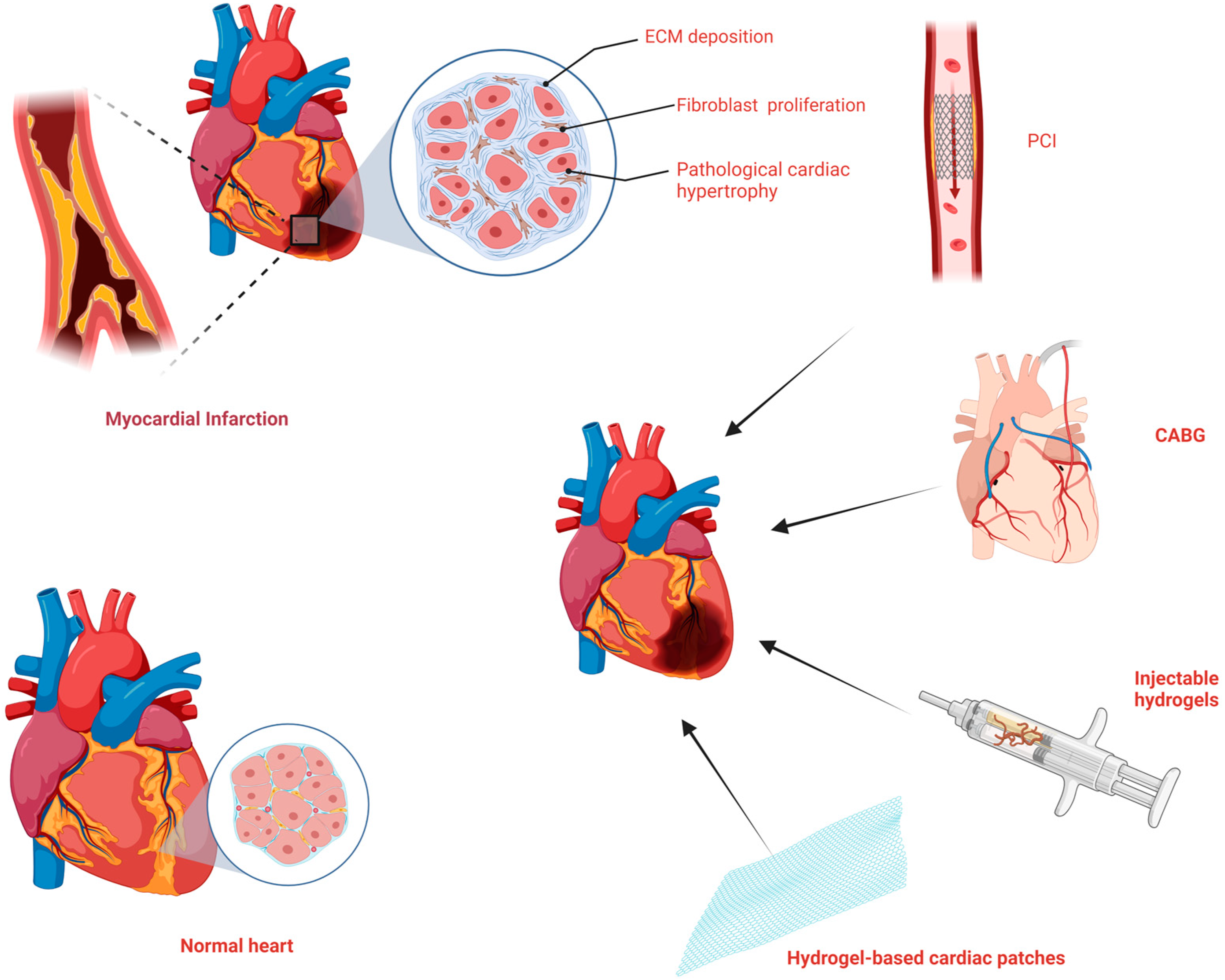 Bioengineering Free Full Text The Role Of Hydrogel In Cardiac