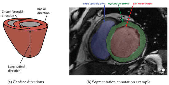 Bioengineering | Free Full-Text | Myocardial Segmentation of Tagged Magnetic Resonance Images ...