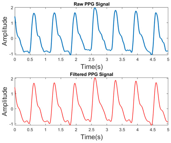Bioengineering | Free Full-Text | Machine Learning-Based Respiration Rate and Blood Oxygen ...