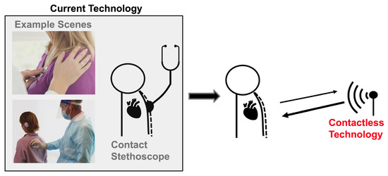 Contactless Stethoscope Enabled by Radar Technology