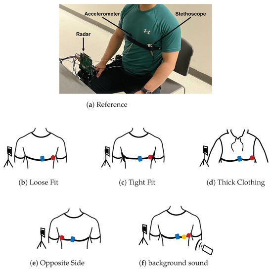 Contactless Stethoscope Enabled by Radar Technology