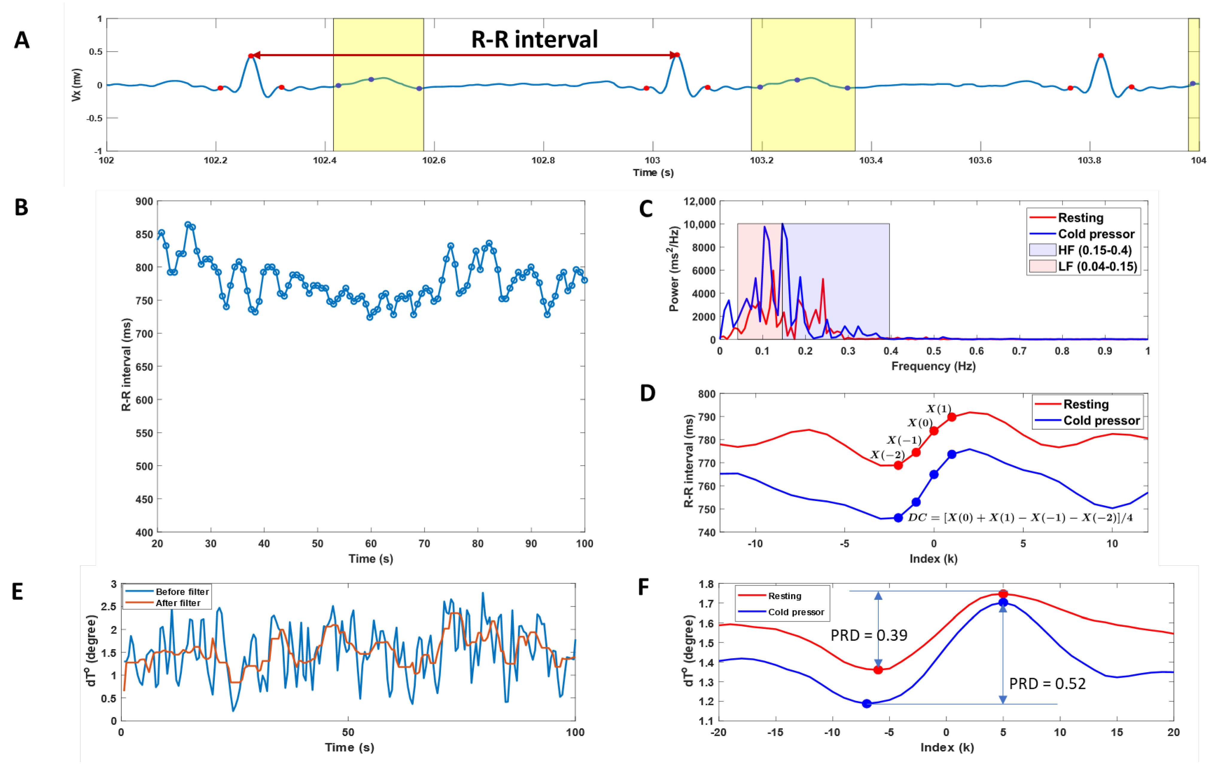 Bioengineering | Free Full-Text | Electrocardiography Assessment of ... Bioengineering | Free Full-Text | Electrocardiography Assessment of ...