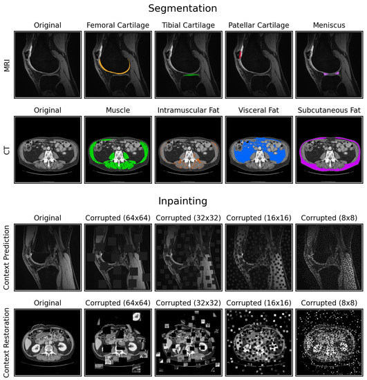 Improving Data-Efficiency and Robustness of Medical Imaging Segmentation Using Inpainting-Based ...
