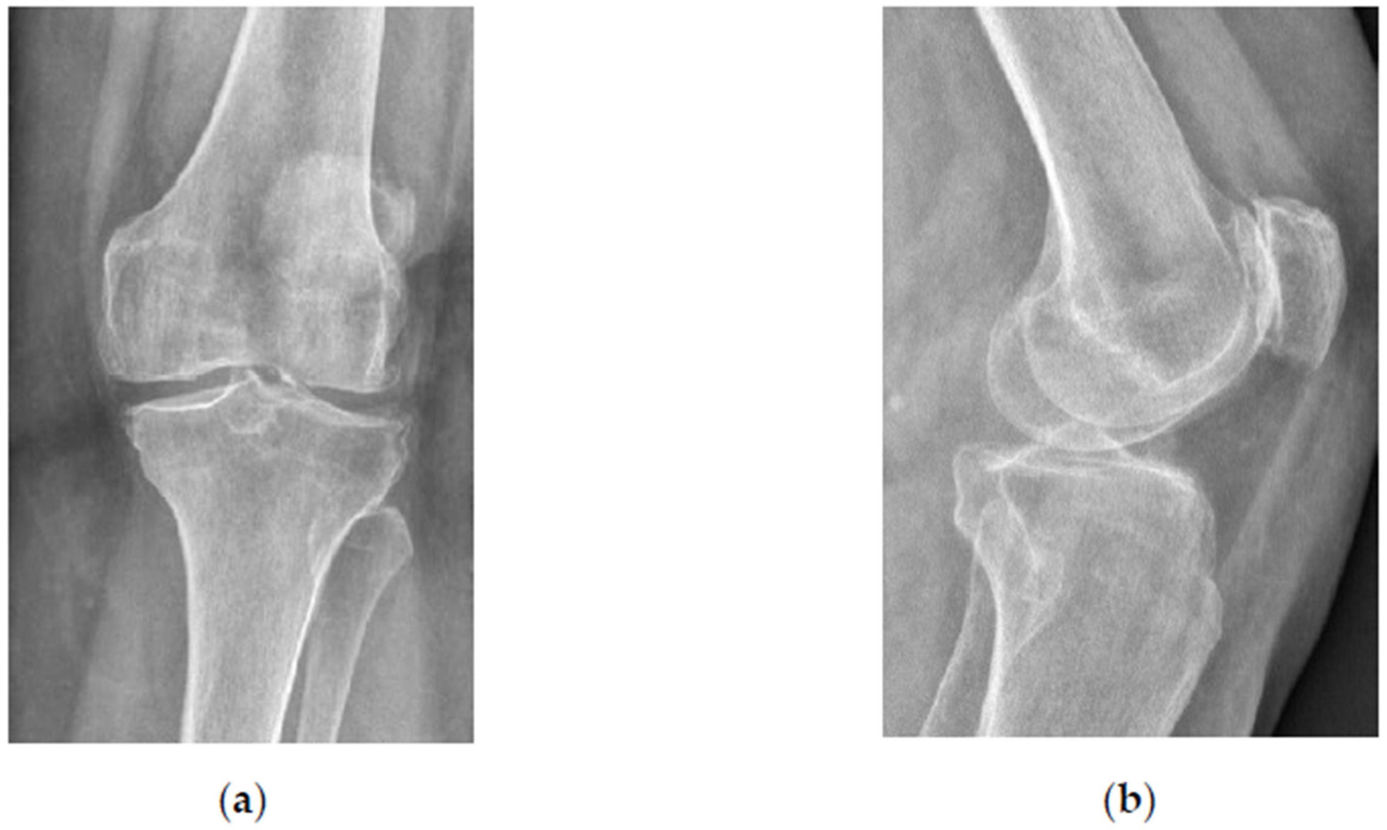 Bioengineering | Free Full-Text | Tissue Integration of Calcium ... Bioengineering | Free Full-Text | Tissue Integration of Calcium ...