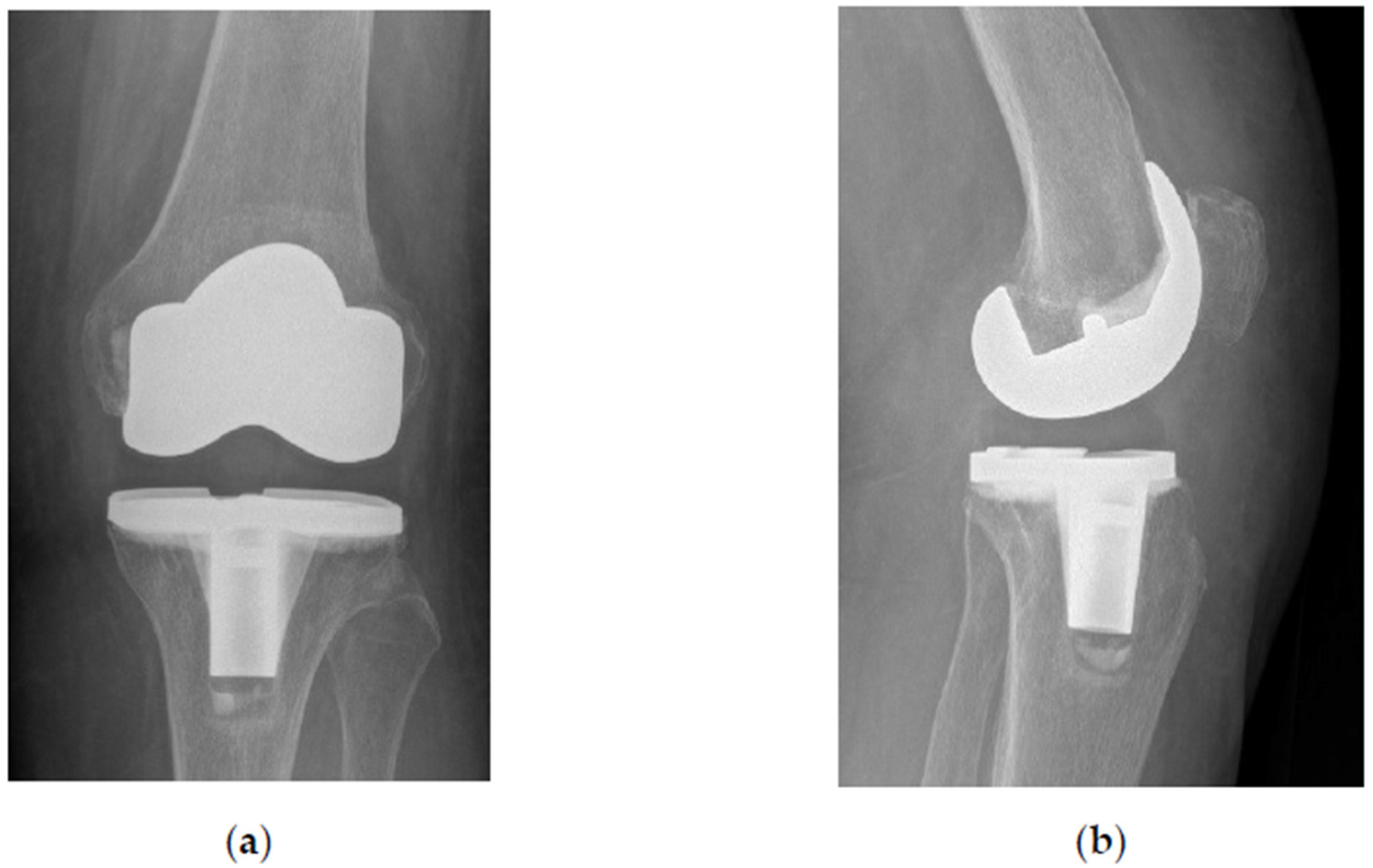 Bioengineering | Free Full-Text | Tissue Integration of Calcium ... Bioengineering | Free Full-Text | Tissue Integration of Calcium ...