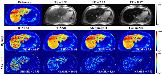 Bioengineering | Free Full-Text | Cascade of Denoising and Mapping ...