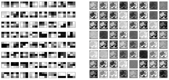 Fully Automatic Liver and Tumor Segmentation from CT Image Using an AIM ...