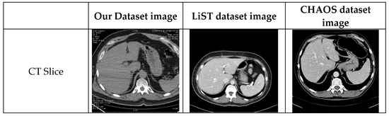 Fully Automatic Liver and Tumor Segmentation from CT Image Using an AIM ...