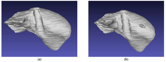 Fully Automatic Liver and Tumor Segmentation from CT Image Using an AIM ...