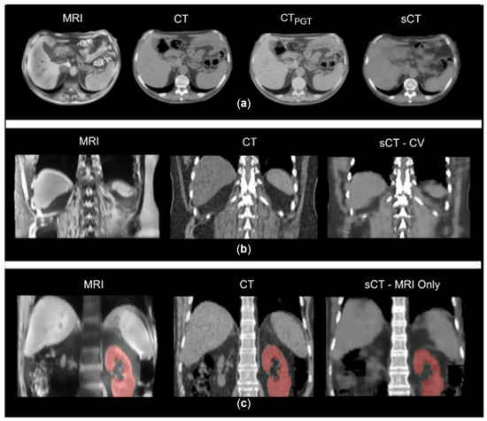 Bioengineering | Free Full-Text | Synthetic CT in Carbon Ion ...