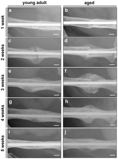 Radiographic, Biomechanical and Histological Characterization of ...