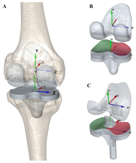 Larger Medial Contact Area and More Anterior Contact Position in Medial ...