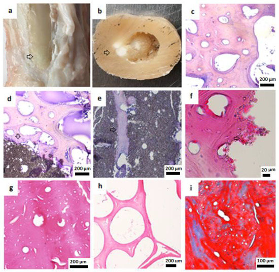 Long-Bone-Regeneration Process in a Sheep Animal Model, Using ...