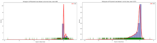 Simple and Powerful PCG Classification Method Based on Selection and Transfer Learning for ...
