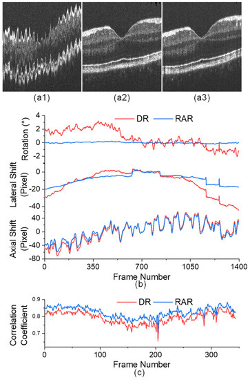 Rotational Distortion and Compensation in Optical Coherence Tomography ...