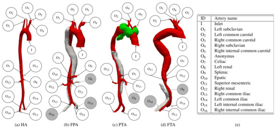 Comparative Analysis of Patient-Specific Aortic Dissections through ...