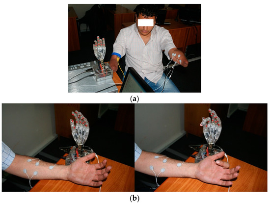 The Role of Fascial Tissue Layer in Electric Signal Transmission from ...
