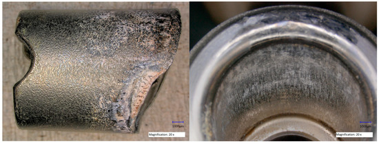 Breakage of Tapered Junctions of Modular Stems in Revision Total Hip ...