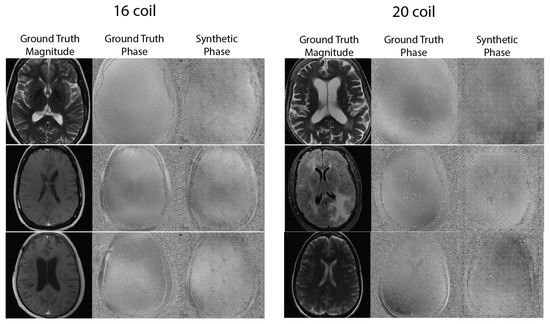 Synthesizing Complex-Valued Multicoil MRI Data from Magnitude-Only Images
