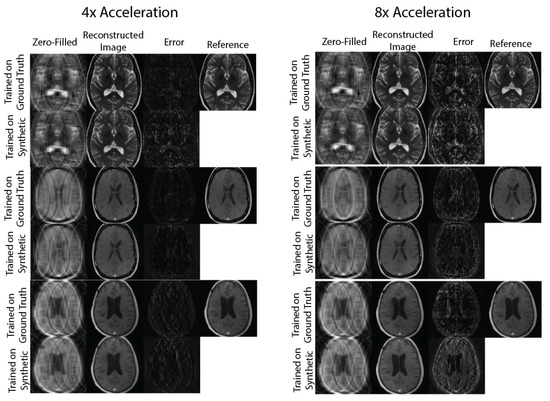 Synthesizing Complex-Valued Multicoil MRI Data from Magnitude-Only Images