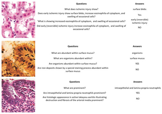 Bioengineering | Free Full-Text | Vision–Language Model for Visual ...