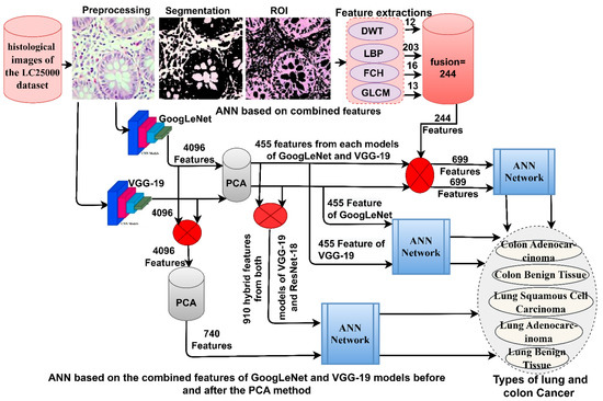 Histopathological Analysis for Detecting Lung and Colon Cancer ...