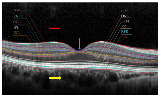 On Machine Learning in Clinical Interpretation of Retinal Diseases Using OCT Images