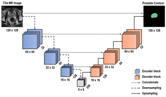 U-Net Architecture for Prostate Segmentation: The Impact of Loss ...