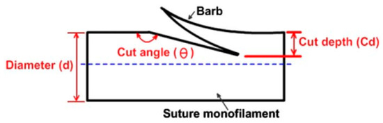 A Review of Barbed Sutures—Evolution, Applications and Clinical ...
