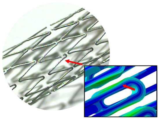 Effects of Tapered-Strut Design on Fatigue Life Enhancement of ...