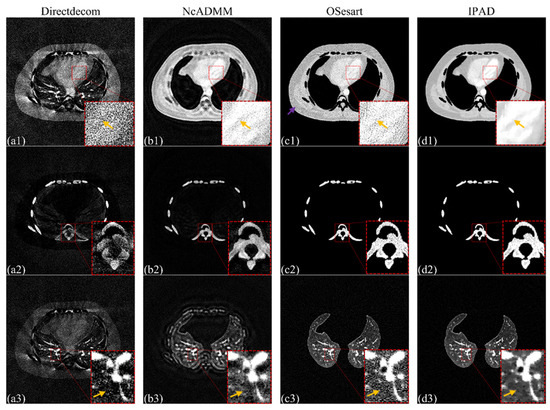 Direct Multi-Material Reconstruction via Iterative Proximal Adaptive ...