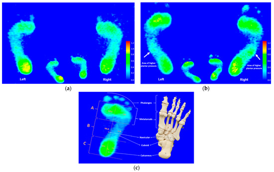 Bioengineering | Free Full-Text | Bipedal Static Supination and Dynamic ...