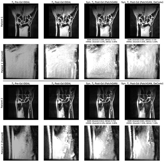 Synthetic Inflammation Imaging with PatchGAN Deep Learning Networks