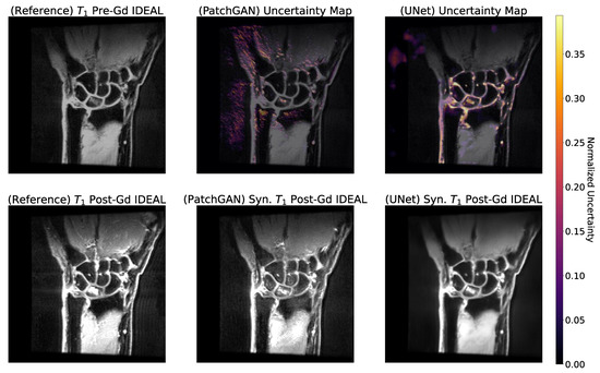 Synthetic Inflammation Imaging with PatchGAN Deep Learning Networks