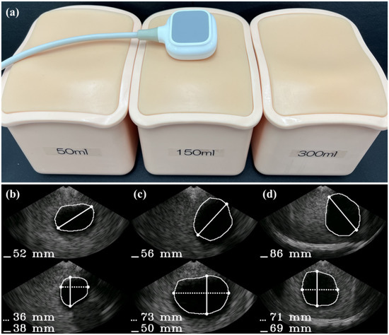A Lightweight Deep Learning Network on a System-on-Chip for Wearable ...