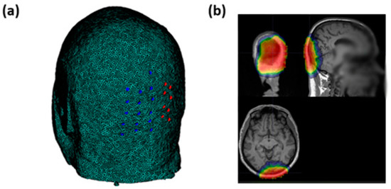 Fast Optical Signals for Real-Time Retinotopy and Brain Computer Interface