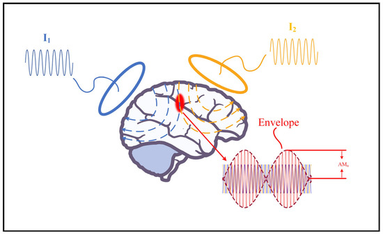 Bioengineering | Free Full-Text | Optimal Design of Array Coils for ...