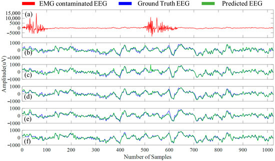 Bioengineering | Free Full-Text | MultiResUNet3+: A Full-Scale ...
