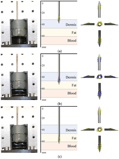 Needle-Based Electrical Impedance Imaging Technology for Needle Navigation