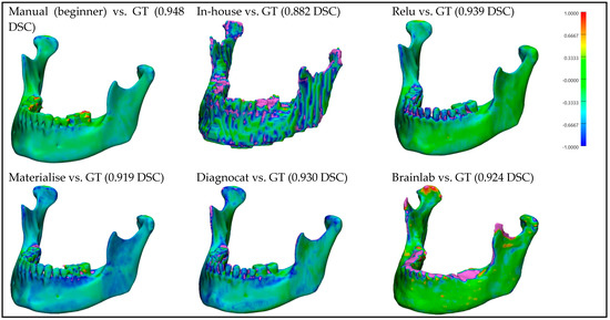 Comparison of Artificial Intelligence-Based Applications for Mandible ...