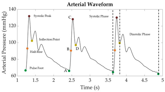 An Explainable Machine-Learning Model for Compensatory Reserve ...