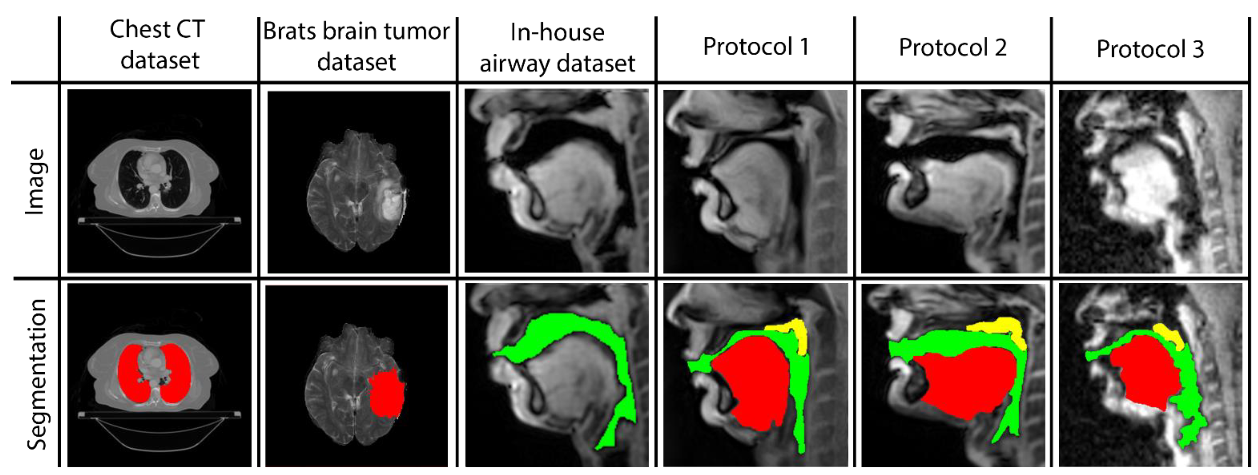 Automatic Multiple Articulator Segmentation in Dynamic Speech MRI Using a Protocol Adaptive ...
