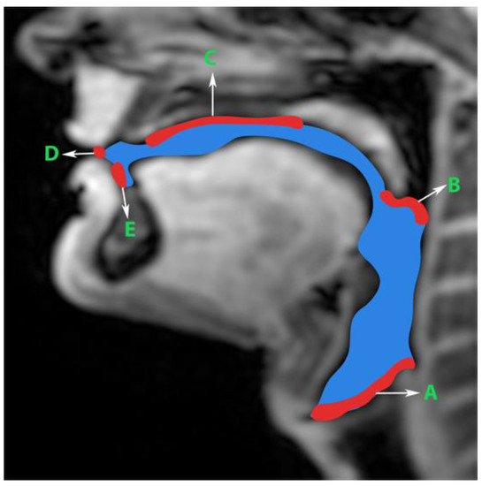 Automatic Multiple Articulator Segmentation in Dynamic Speech MRI Using a Protocol Adaptive ...