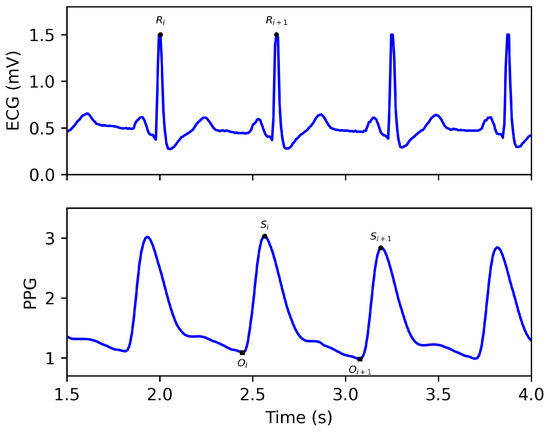 PPG2ECGps: An End-to-End Subject-Specific Deep Neural Network Model for Electrocardiogram ...